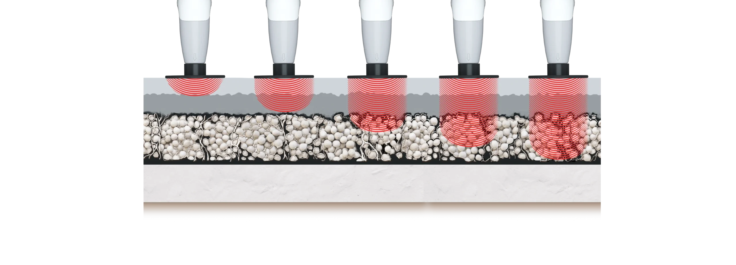 Soft Tissue Treatment by NuEra® tight - Alpha Medical Aesthetics